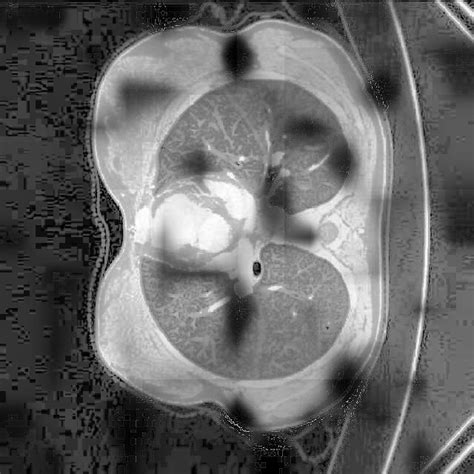 Lung Cancer Classification Model V3 2023 09 02 4 54pm By Unitec