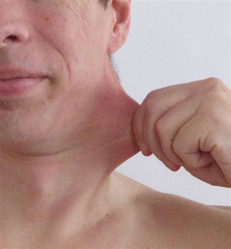 Why Does Skin Lose Its Elasticity As We Get Old