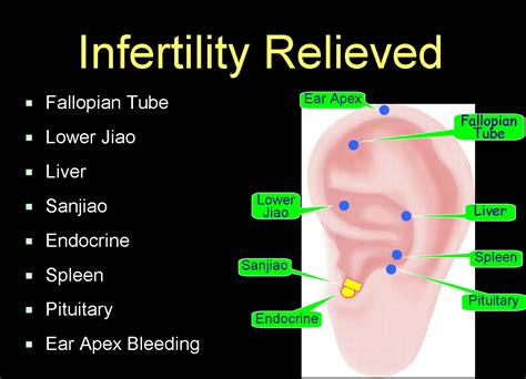 Practice Of Auricular Diagnosis And Treatment In The Clinic Actual Cases Of Many Different Diseases