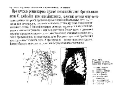Частная остеология строение и возрастные особенности черепа рентгенанатомия костей презентация