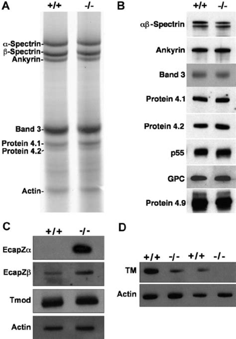 Membrane Skeleton In ␣ Adducinnull Rbcs The Major Membrane Skeleton