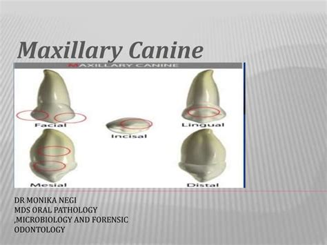 Permanent Maxillary Canine Pptx