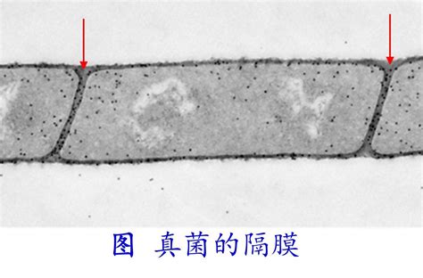 科学网—环境微生物之真菌 王从彦的博文