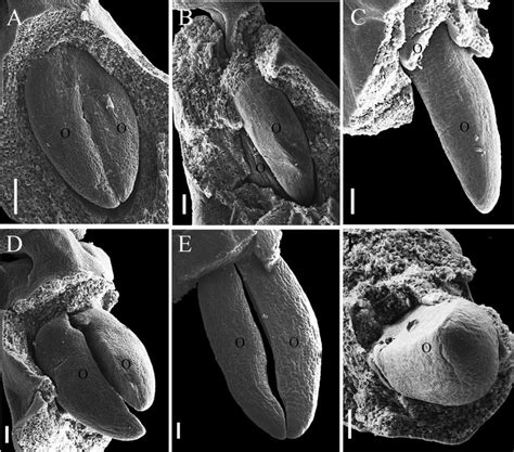 Sem Of Ovular Development In Cardiopteris Platycarpa The Ovule Has No
