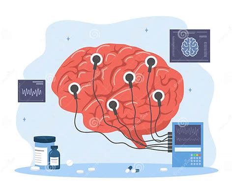 Epilepsy Concept Treatment Nervous System Electroencephalography Stock Vector Illustration