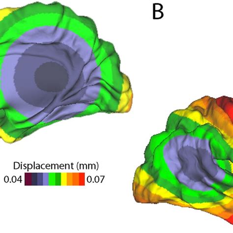 Spatial Variation Of Motion Artifacts A Motion Is Minimal In The