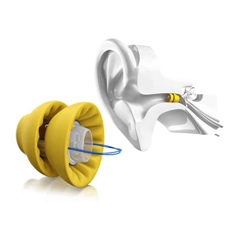 Phonak Audeo Lumity Hearing Aids Birkdale Audiology