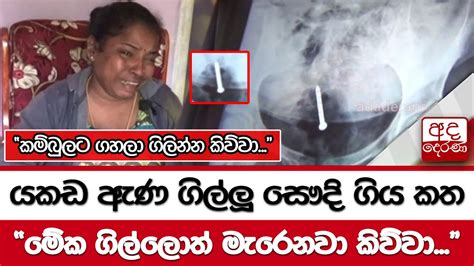යකඩ ඇණ ගිල්ලූ සෞදි ගිය කත මේක ගිල්ලොත් මැරෙනවා කිව්වා කම්බුලට ගහලා ගිලින්න කිව්වා