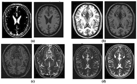Diagnostics Free Full Text An Enhanced Machine Learning Approach For Brain Mri Classification