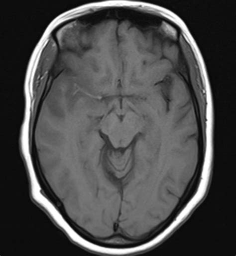 Case Radiology Wiki Radiology Teleradiology Freeservice Neuroimaging… Wiki Radiology