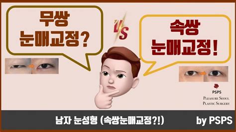 남자눈성형은 무쌍눈매교정 X 속쌍눈매교정 O By 성형외과 전문의 Youtube