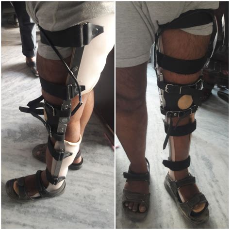 Polio Leg Braces