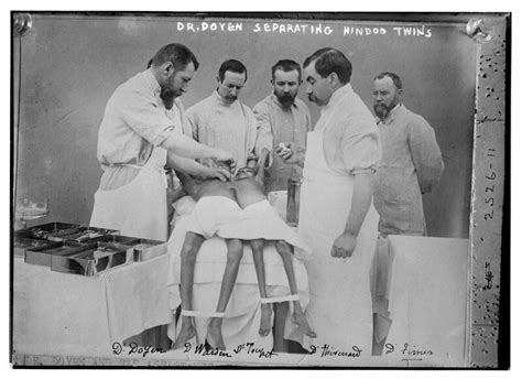 Операция по разделению сиамских близнецов 1902 й год 477768 — Livejournal