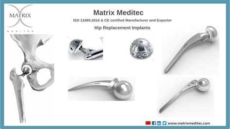 Different Types Of Hip Replacement Implants Matrix Meditec Medium