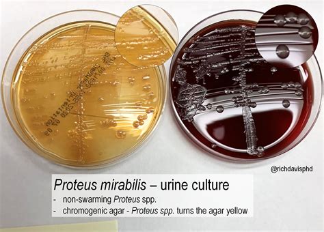 Proteus Mirabilis Swarming