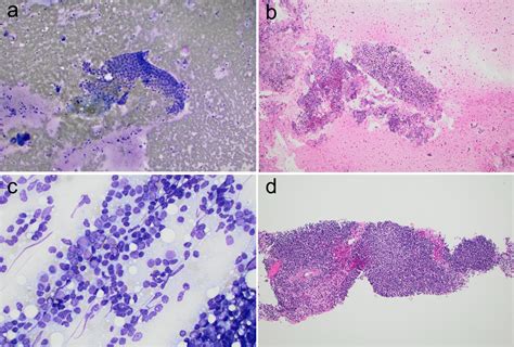 Introduction Of The Who Reporting System For Lymph Node Cytopathology