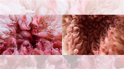 Pics Show A Vagina Under A Microscope