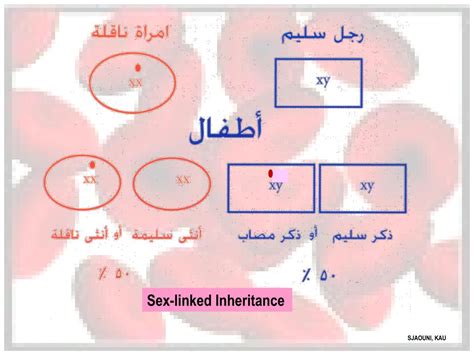 PPT Hemolytic Anemias PowerPoint Presentation Free Download ID 4632555