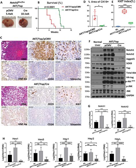 Notch2 Controls Hepatocyte Derived Cholangiocarcinoma Formation In Mice