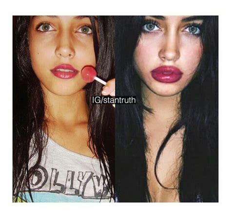 Cindy Kimberly Atozplasticsurgery