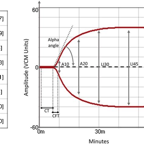 A Typical VCM Trace That Shows VCM Measurement Parameters CT Clotting Download Scientific