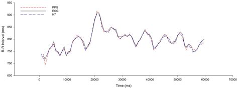 Figure 1 From Comparison Of Heart Rate Variability Recording With Smartphone