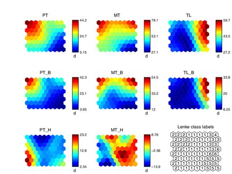 Visualization For Each Cobb Angle Download Scientific Diagram