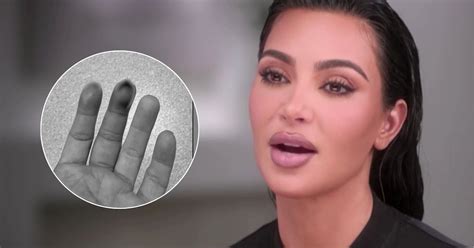 Kim Kardashian Sufrió Una Fractura En Su Mano Tras Golpearse Con Una