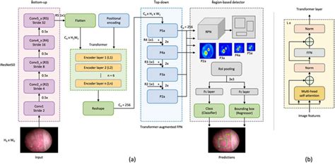 Tumor Detection Under Cystoscopy With Transformer Augmented Deep Learning Algorithm Pmc