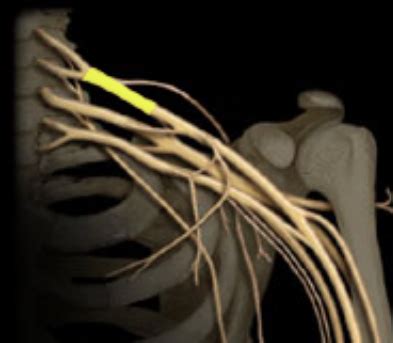 PT Brachial Plexus Lecture Flashcards Quizlet