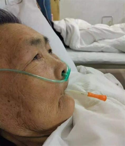 一位加護病房醫師的告白：「我是醫師，時候到了，也絕不要被插鼻胃管！」下場真的很慘！一定要讓親友也知道！
