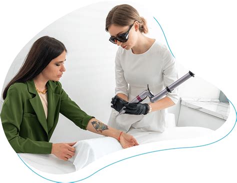 Radiation Tattoo Removal