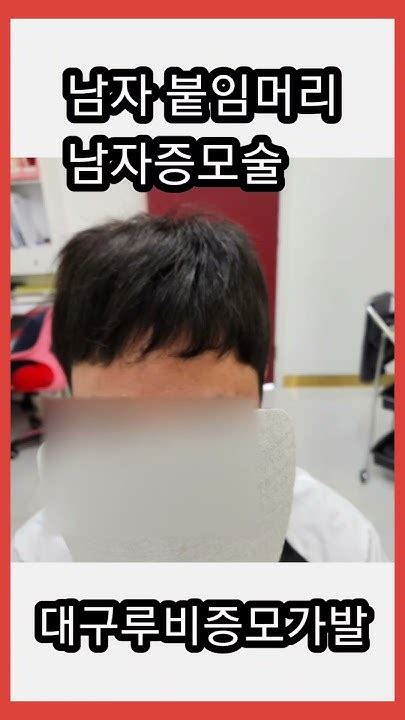 남자붙임머리 엠자 앞머리 정수리 탈모대구가발 Shots 엠자탈모 Youtube