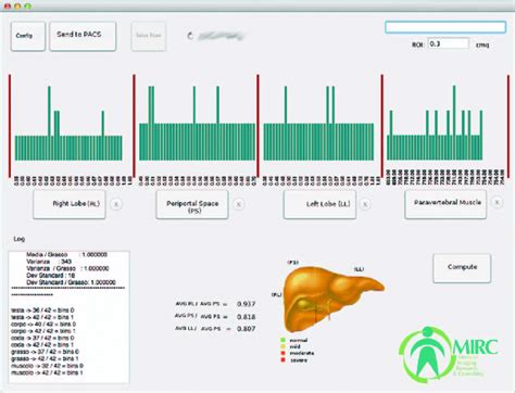 The Liomot Gui Showing Output After Iron Overload Estimation Download Scientific Diagram