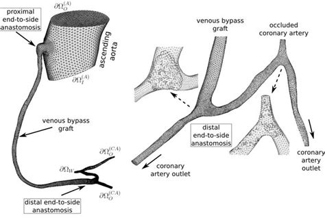 Individual Graft Unstructured Computational Mesh And Relevant Terminology Download Scientific