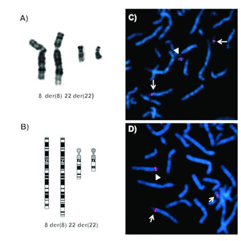 Array Comparative Genome Hybridization Profiles Of The Chromosomes Download Scientific Diagram