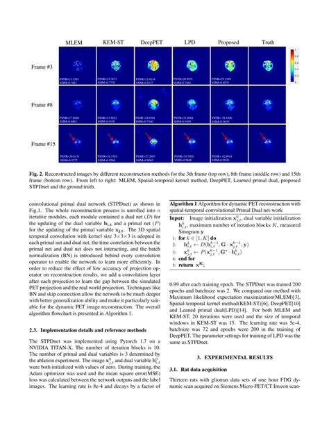 Stpdnet Spatial Temporal Convolutional Primal Dual Network For Dynamic