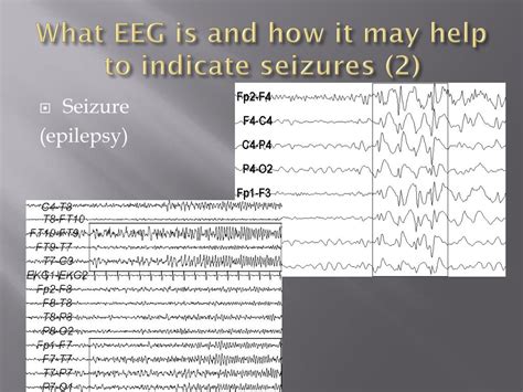 Ppt A Stochastic Framework For Evaluating Seizure Prediction