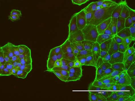 Panagiota Tsokkou On Linkedin Lab Grown Bone Cell Breakthrough Heralds
