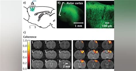 Neurologylight Tissue Interaction In Vivo Precision Targeting With Optogenetics Laser Focus