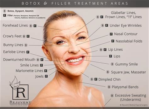 Printable Botox Injection Face Map