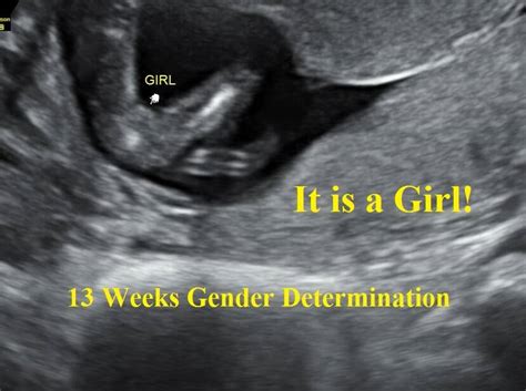 Its A Girl Ultrasound 3d