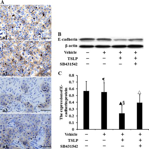 Figure 2 From Tslp Induces Epithelialmesenchymal Transition In Nasal