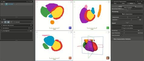 manually editing a label map in the suite imfusion suite imfusion support forum