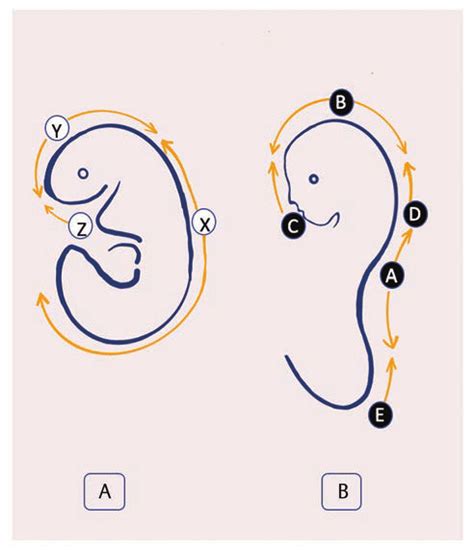 Diagram Representing Order Of Events Involved In Primary Neurulation