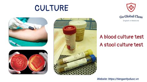 What Do They Check For In Stool Culture At Orlando Britt Blog