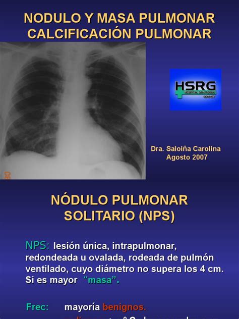 Nodulo Pulmonar Pdf Sarcoma Metástasis