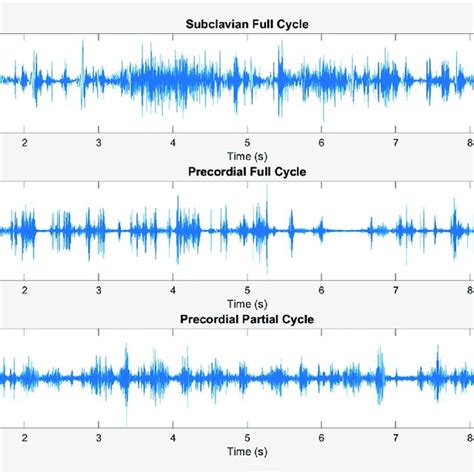 Examples Of Spencer Grade 4 For 3 Conditions 1 Subclavian Data With Download Scientific