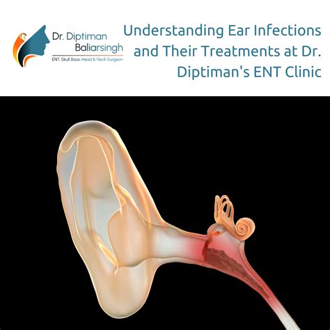 Understanding Ear Infections And Their Treatments At Dr Diptiman S