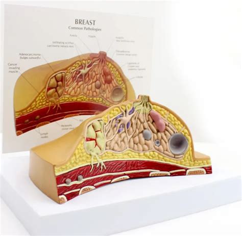Longitudinal Cut Of Breast Model With Illness Buy Breast Modelbreast